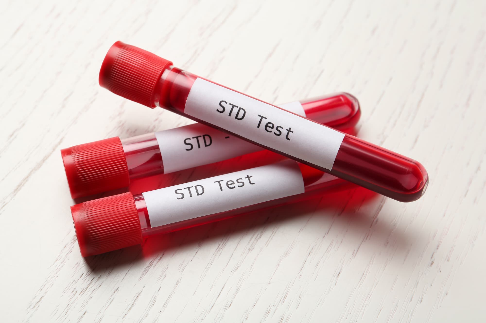 how do you know if you have an std? | ARCpoint Labs of Martinez, CA