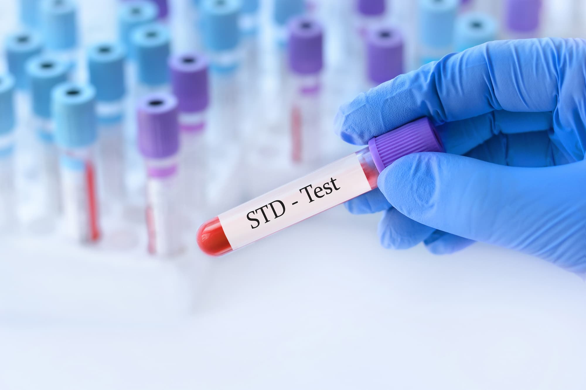 What Are The Top 10 Sexually Transmitted Diseases? | ARCpoint Labs of ...