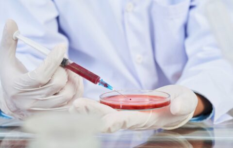 Guide to Lyme Disease Testing and Health Screenings - ARCpoint Labs ...