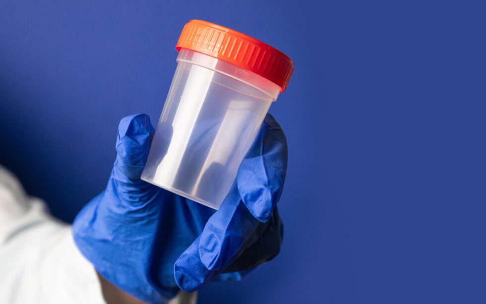 How to Choose the Right Drug Test Panel for Your Workplace